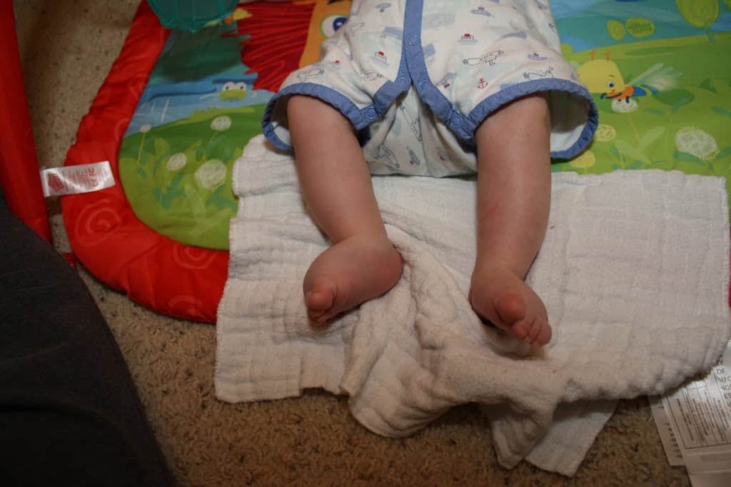 Pediatric Primary Lymphedema · Lymph Balance Centre